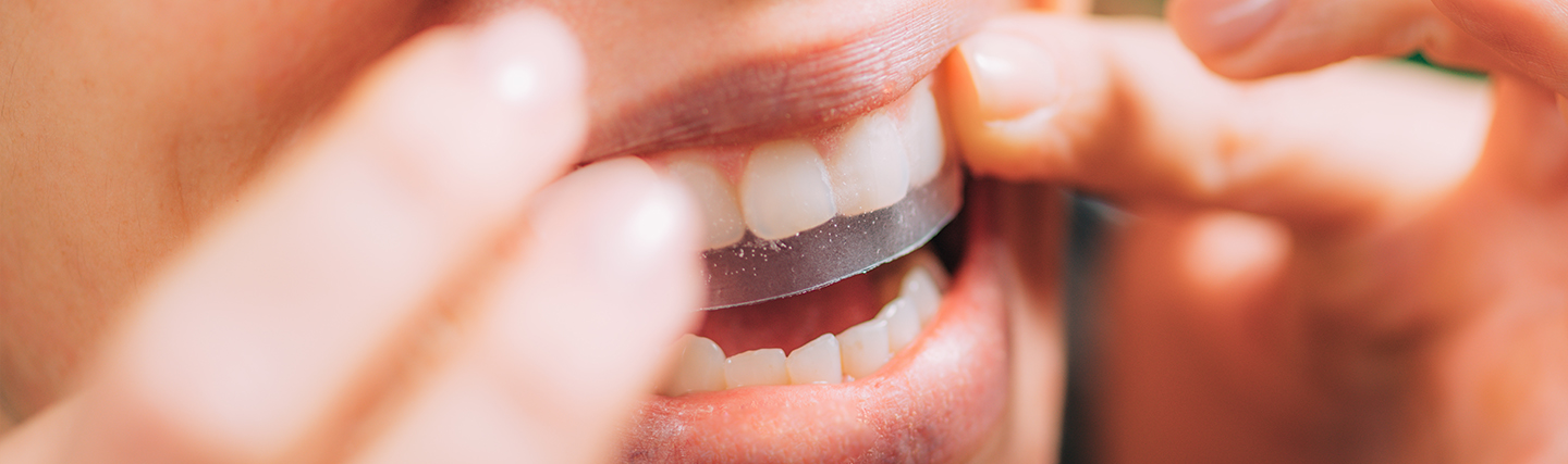 چسب سفید کننده دندان +PAP اسمایل کیت SMILE KIT | PAP+ Teeth Whitening ...